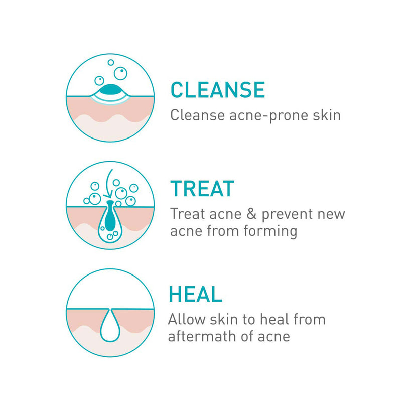 CeraVe - Acne Foaming Cream Cleanser - 150 mL – MYQT.com.au